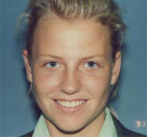 Ear Surgery Before and After Pictures in Washington, Vienna, VA