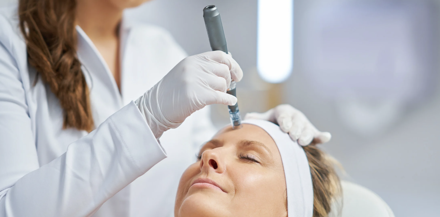 Morpheus8 RF Microneedling Cost and Results in Vienna - Younger Image ...